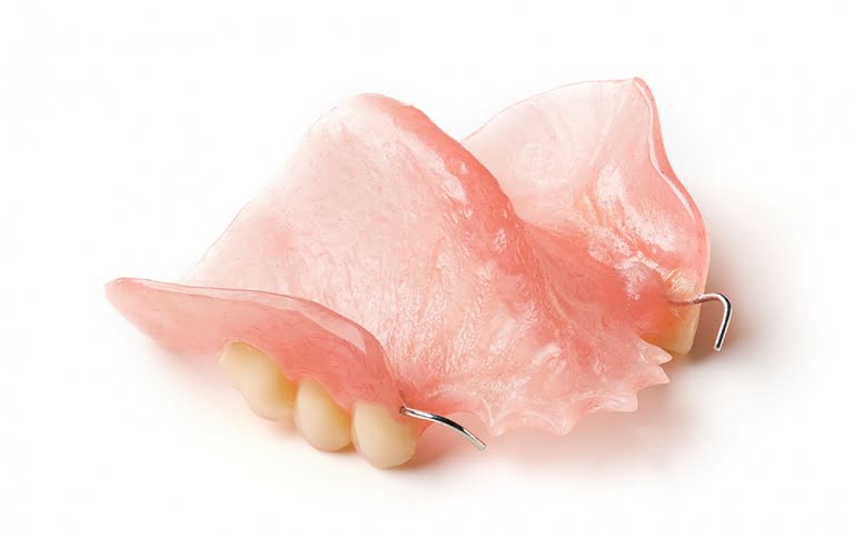 Full Mouth Dentures: For an everlasting and confident smile